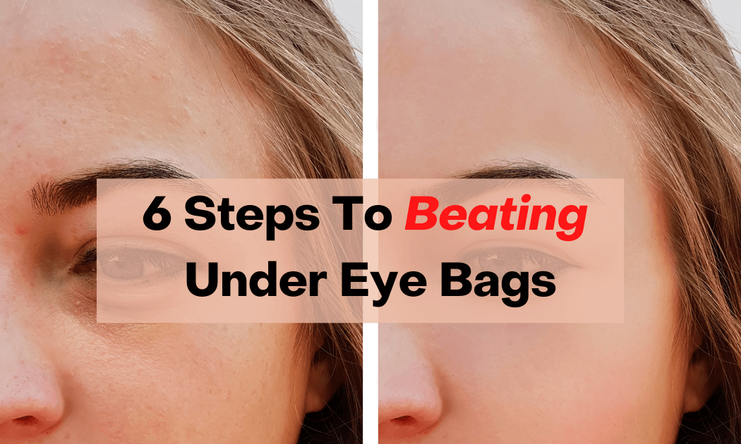 6 Steps To Beating Under Eye Bags